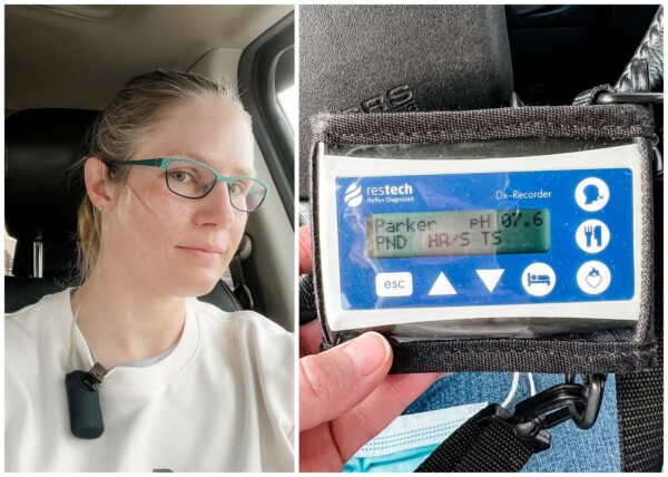 My Experience with the LINX Procedure • The Fit Cookie